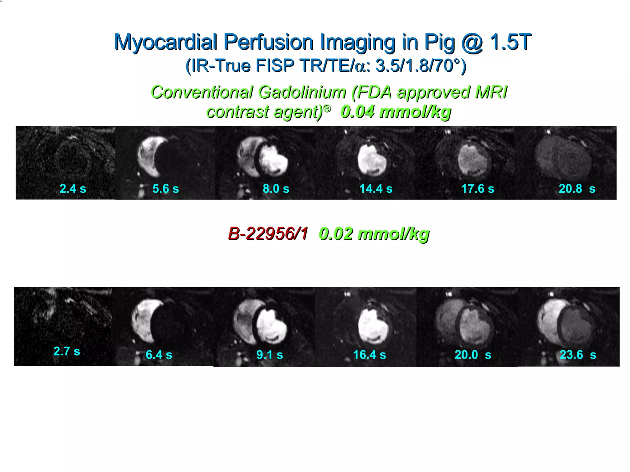 Single Session of MR Coronary Angiography and Myocardial Perfusion ...