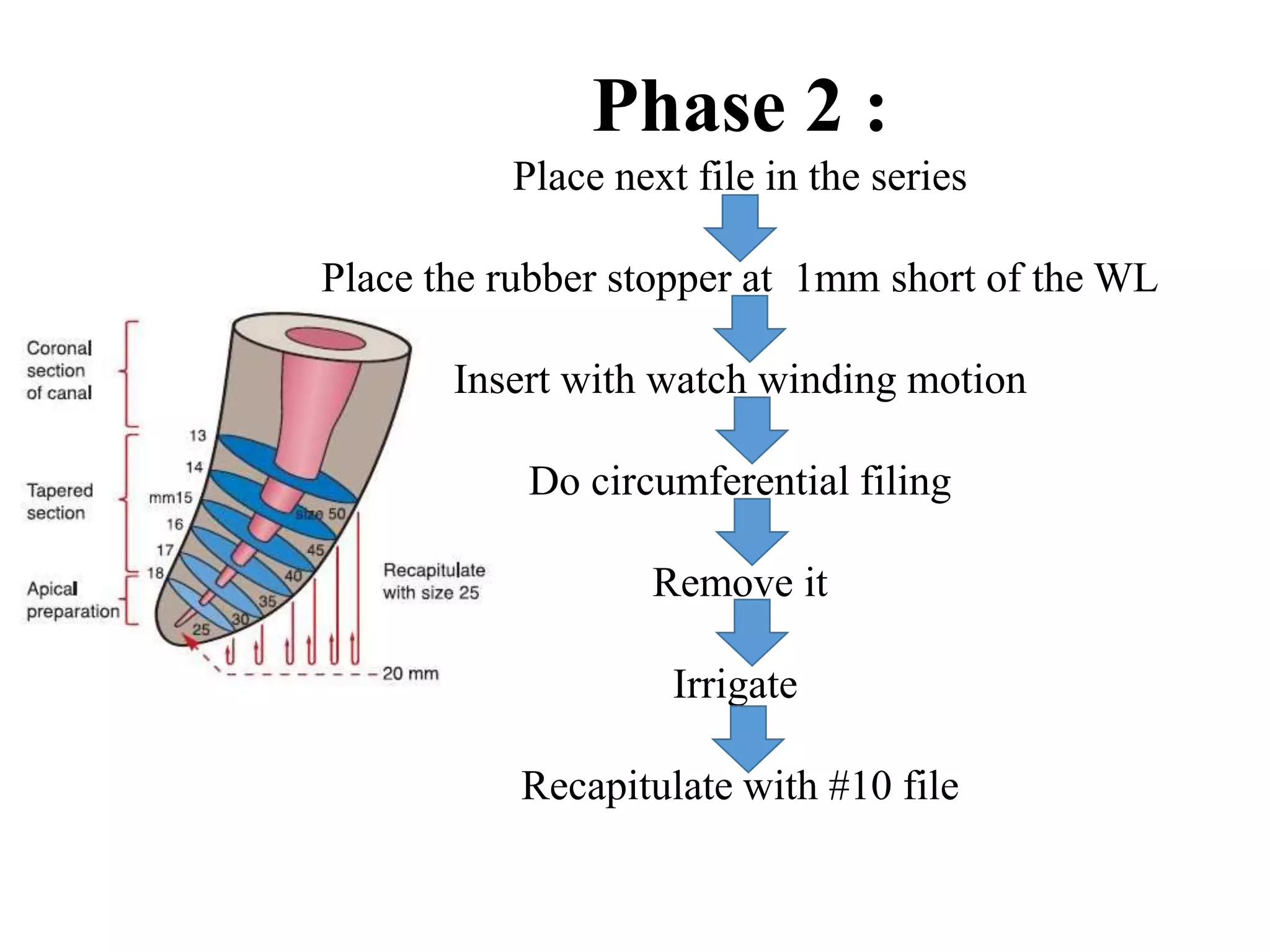 cleaning and shaping of root canal therapy | PPTX