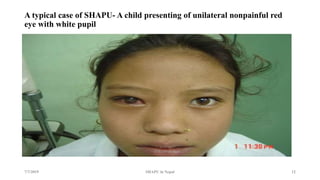 Shapu in nepal | PPTX