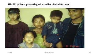Shapu in nepal | PPTX