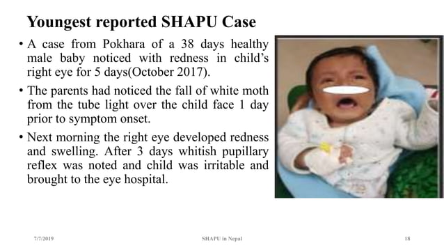 Shapu in nepal | PPTX | Eye and Vision Conditions | Diseases and Conditions