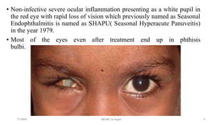 Shapu in nepal | PPTX