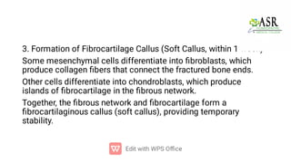 General anatomy Joints - fractures and disorders | PPT