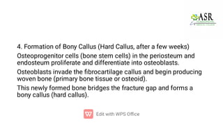 General anatomy Joints - fractures and disorders | PPT