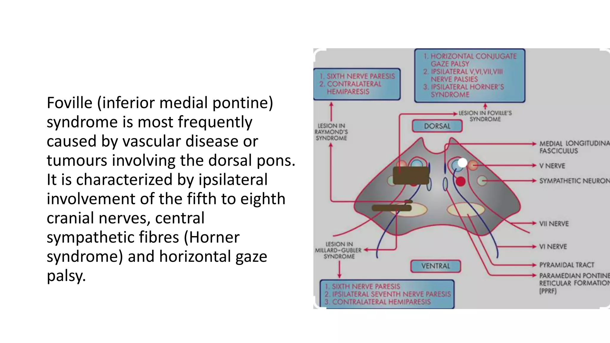 Anatomy of 6th cranial nerve.pptx
