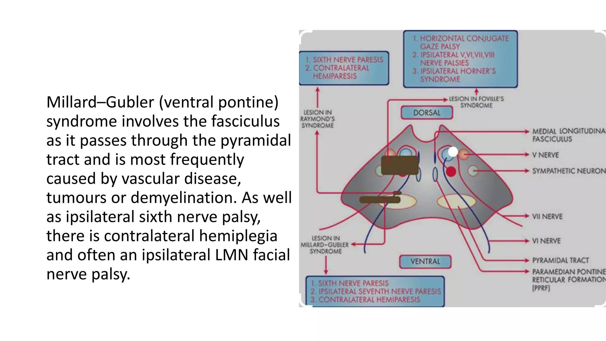 Anatomy of 6th cranial nerve.pptx