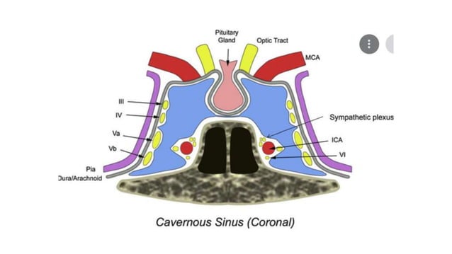 Anatomy of 6th cranial nerve.pptx