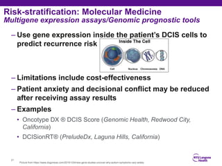 Topic-Driven Round Table on DCIS: What are Your Radiation Options? | PPT
