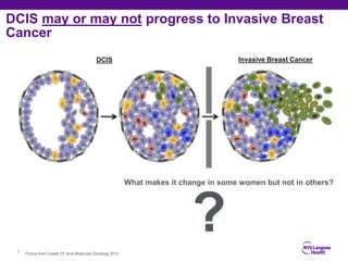 Topic-Driven Round Table on DCIS: What are Your Radiation Options? | PPT