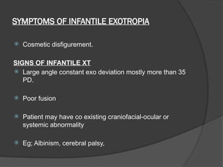 Squint Share DIVERGENT STRABISMUS - Copy.pptx