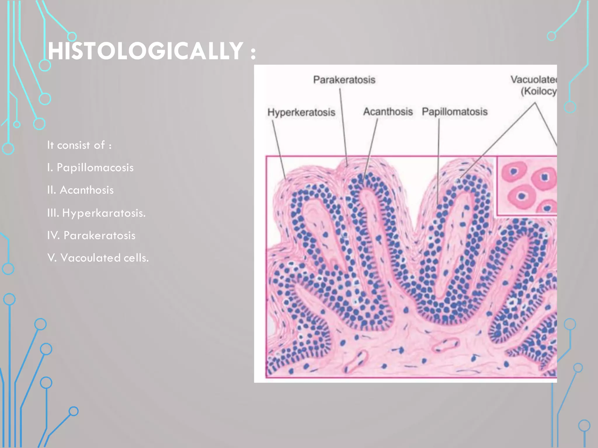 Infectious dermatoses-Pathology | PDF