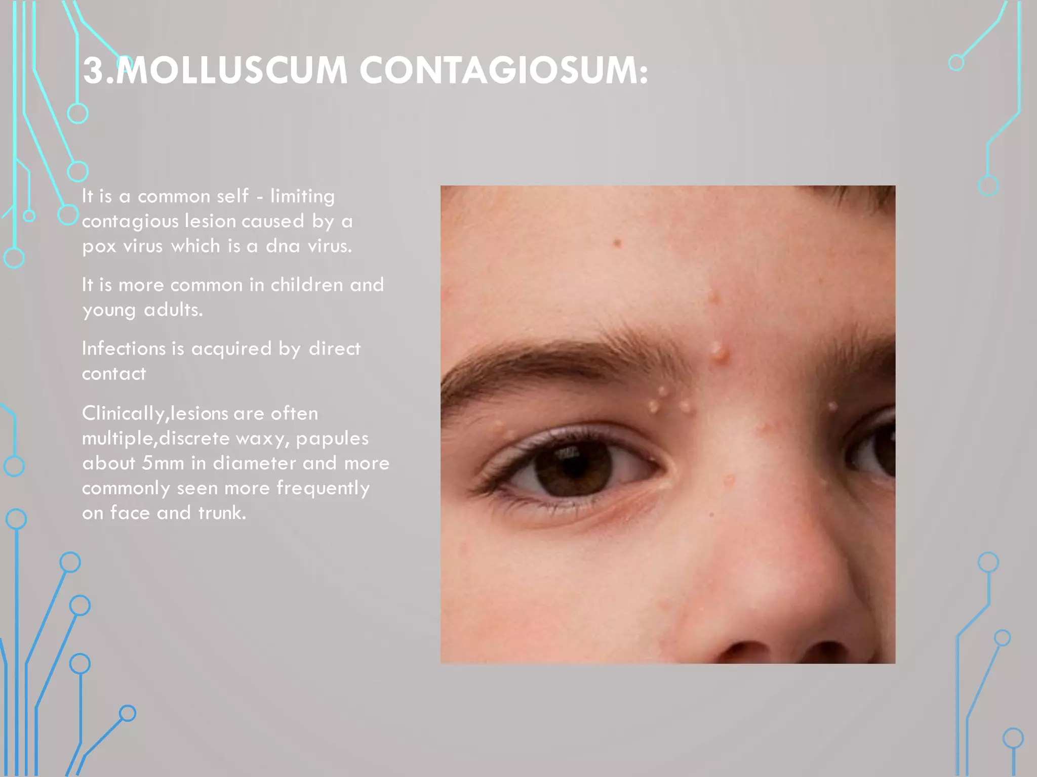 Infectious dermatoses-Pathology | PDF