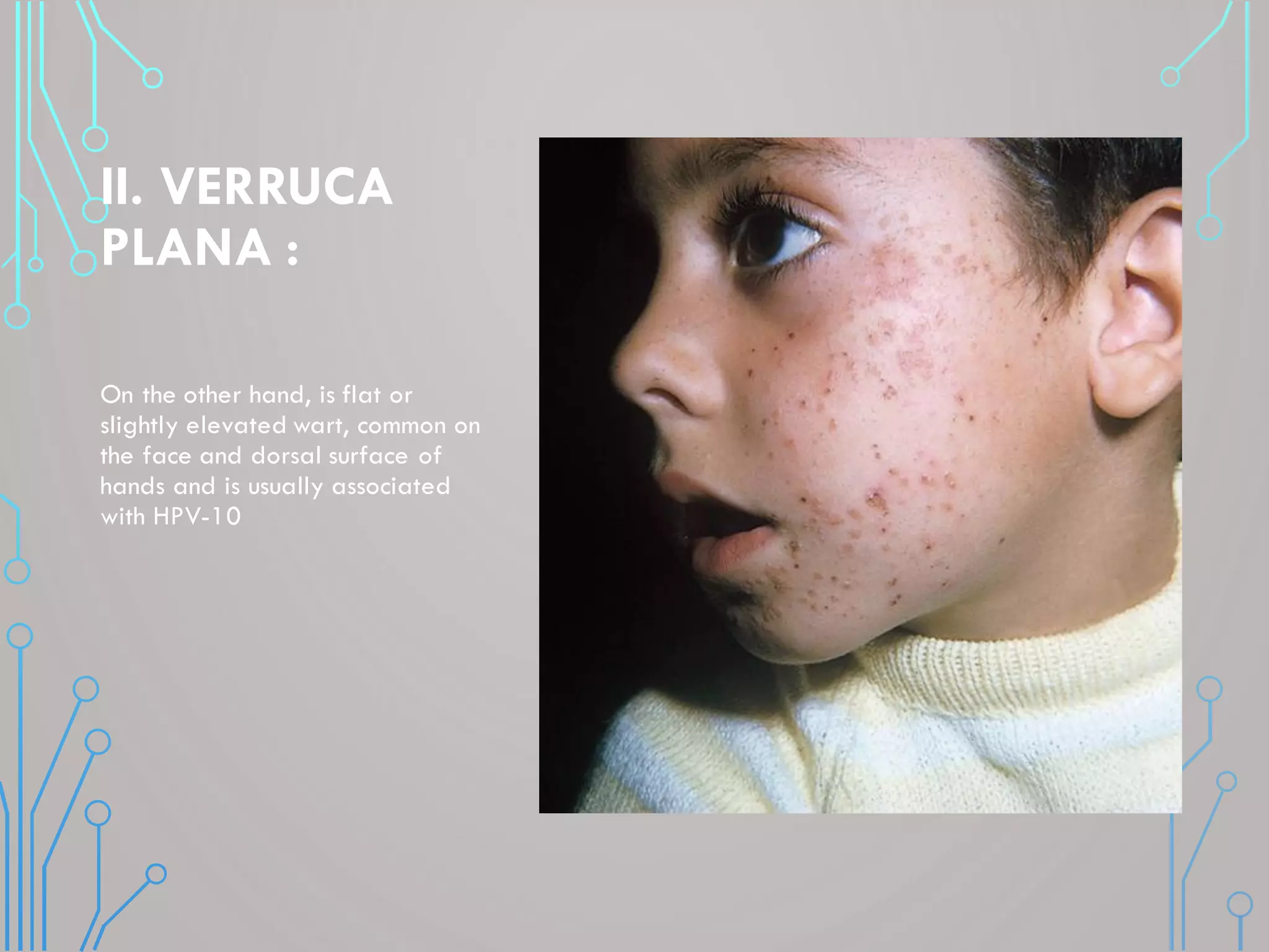 Infectious dermatoses-Pathology | PDF