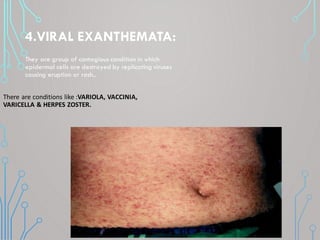 Infectious dermatoses-Pathology | PDF