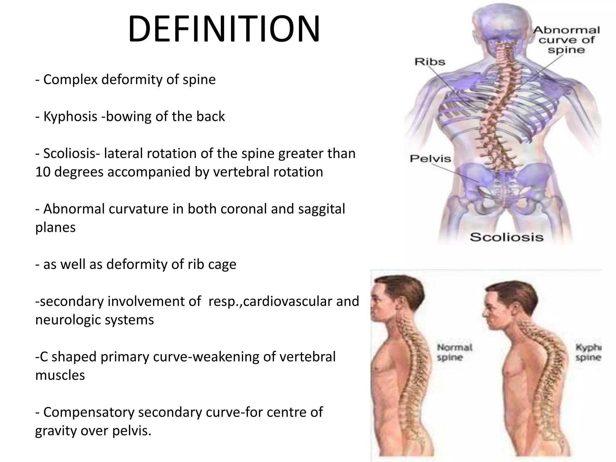 kyphoscoliosis | PPTX