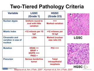 Topic-Driven Round Table on Low Grade Serous Ovarian Cancer | PPT