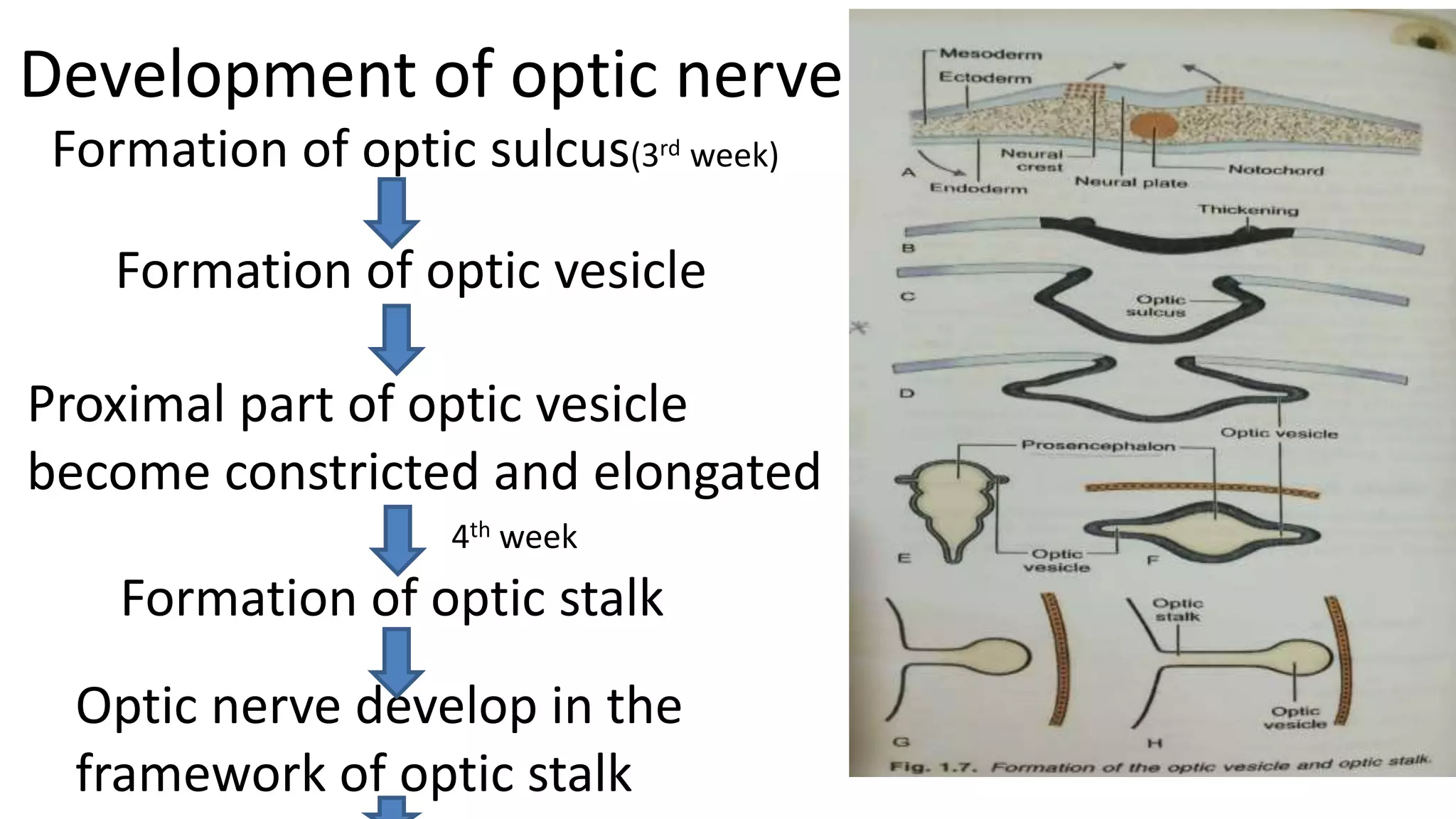 Optic Nerve and Visual pathway.pptx