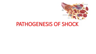 Share PATHOGENESIS OF SHOCK in medicine.pptx