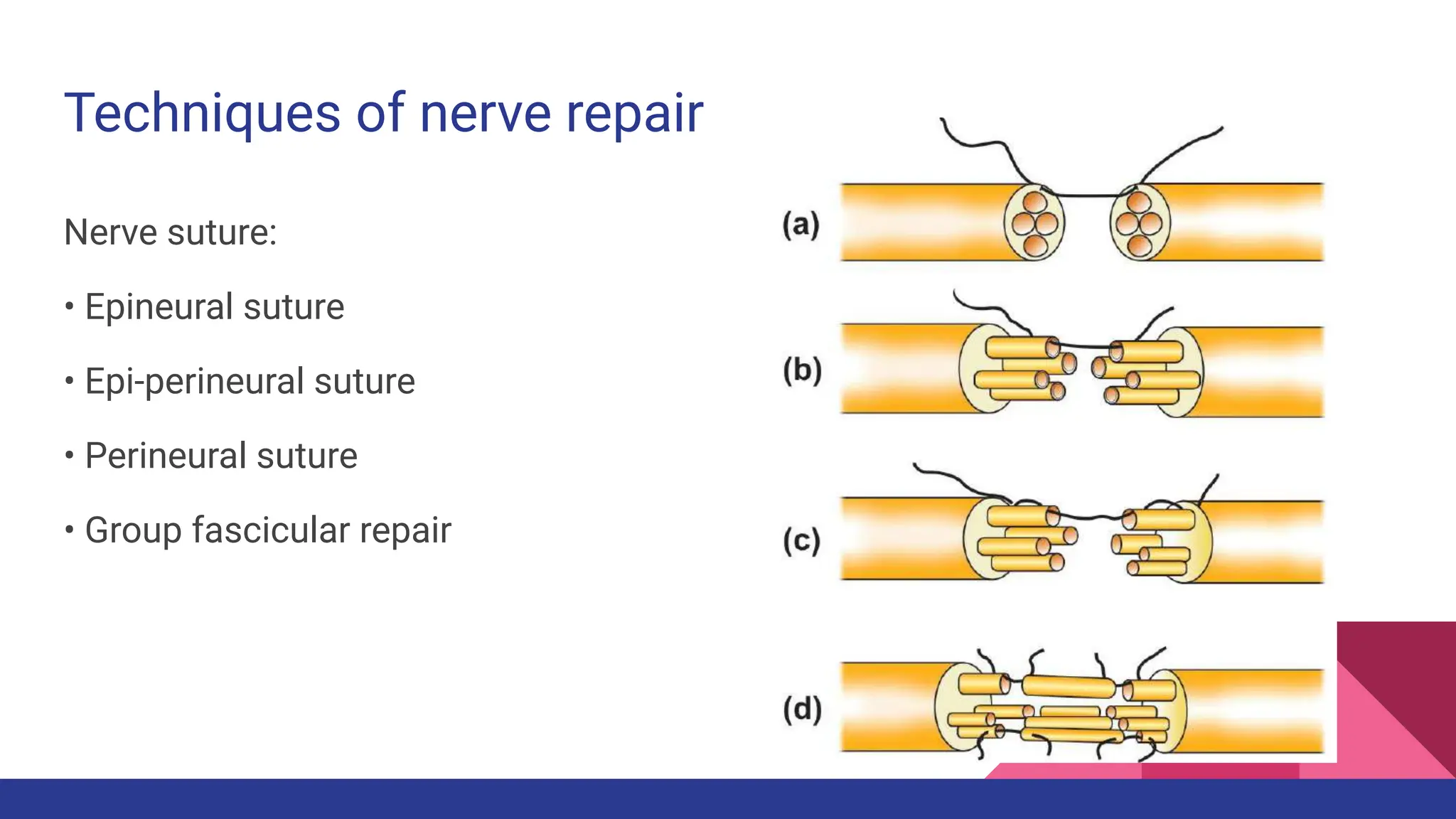 Share Peripheral nerve injuries ppt download | PDF