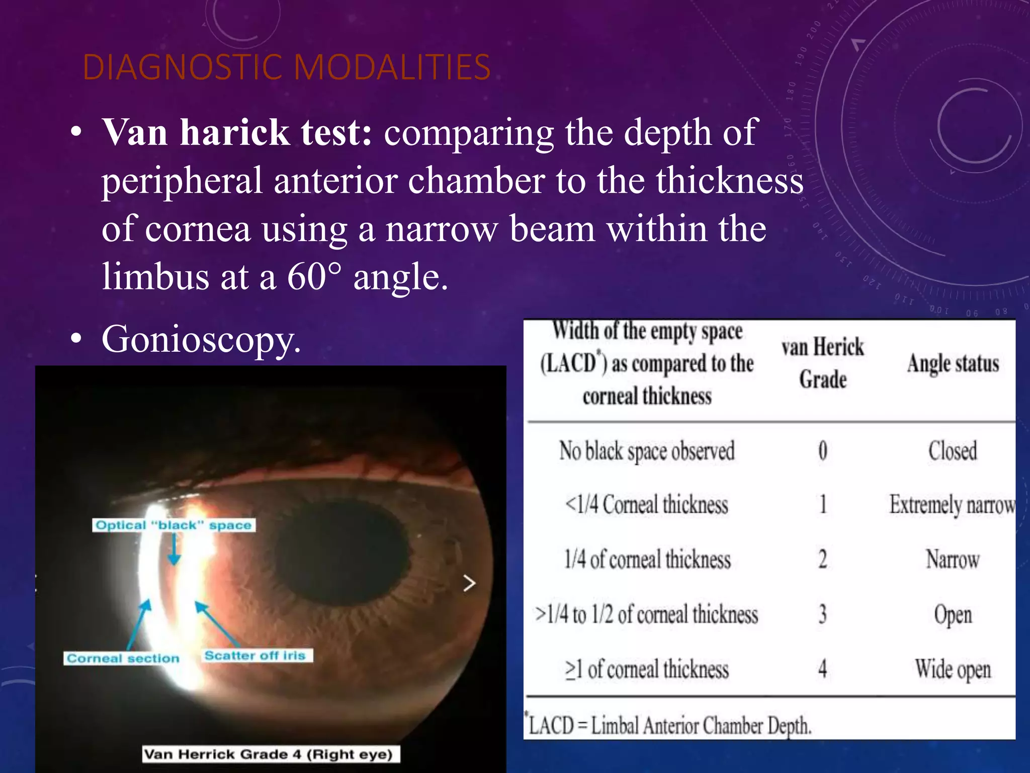 anatomy of anterior chamber of eye | PPTX