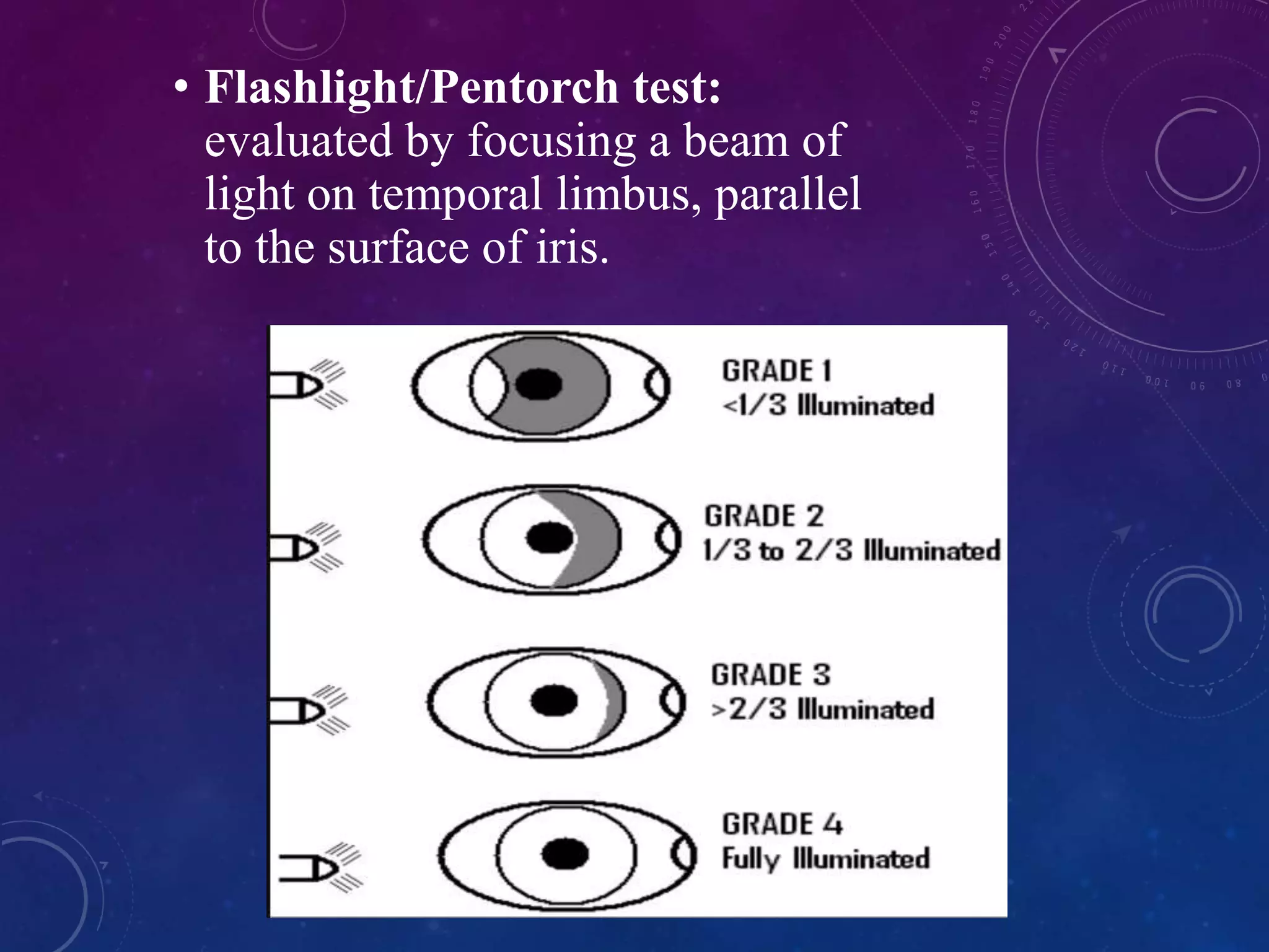 anatomy of anterior chamber of eye | PPTX