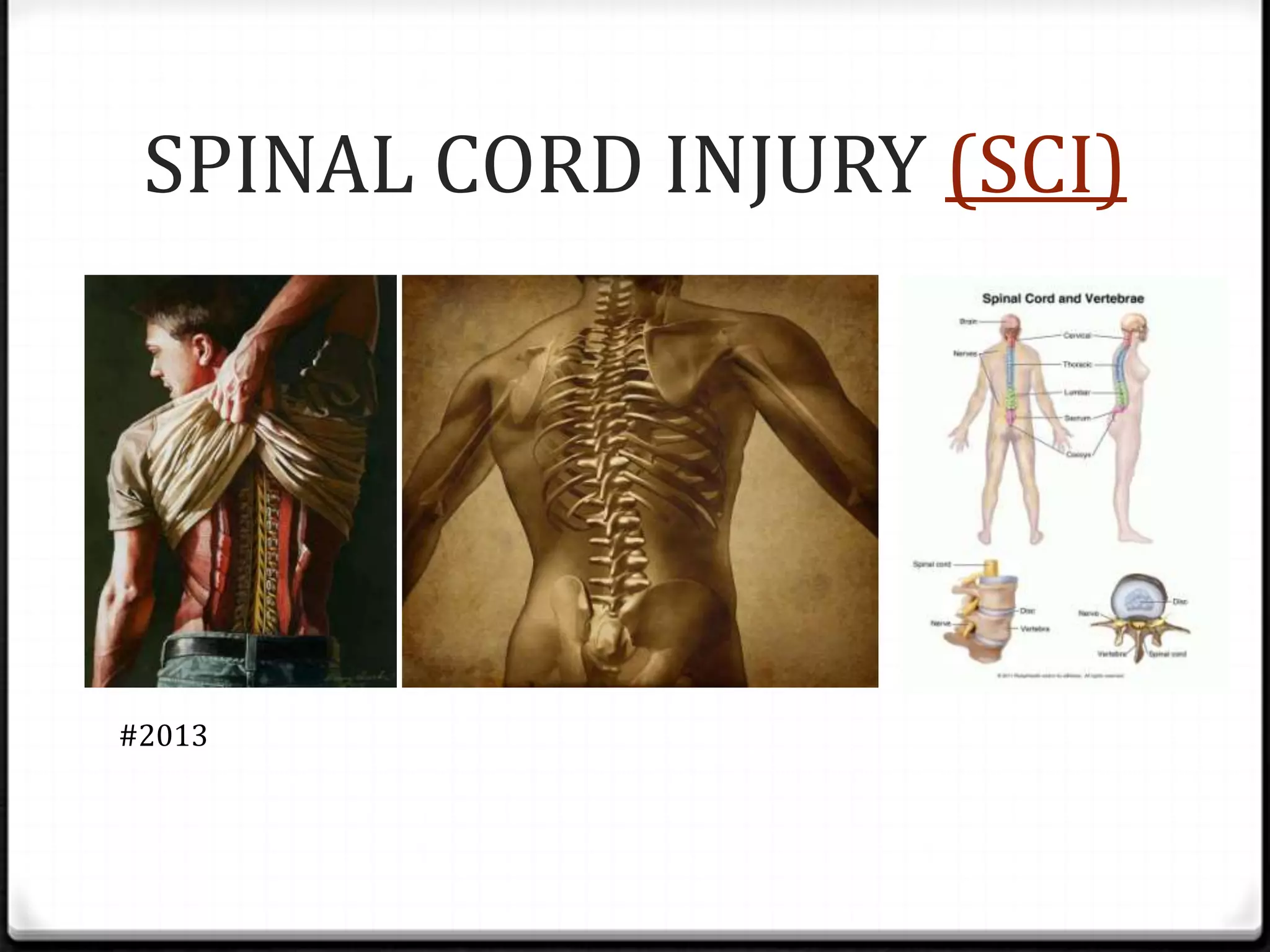 spinal cord injury | PPTX