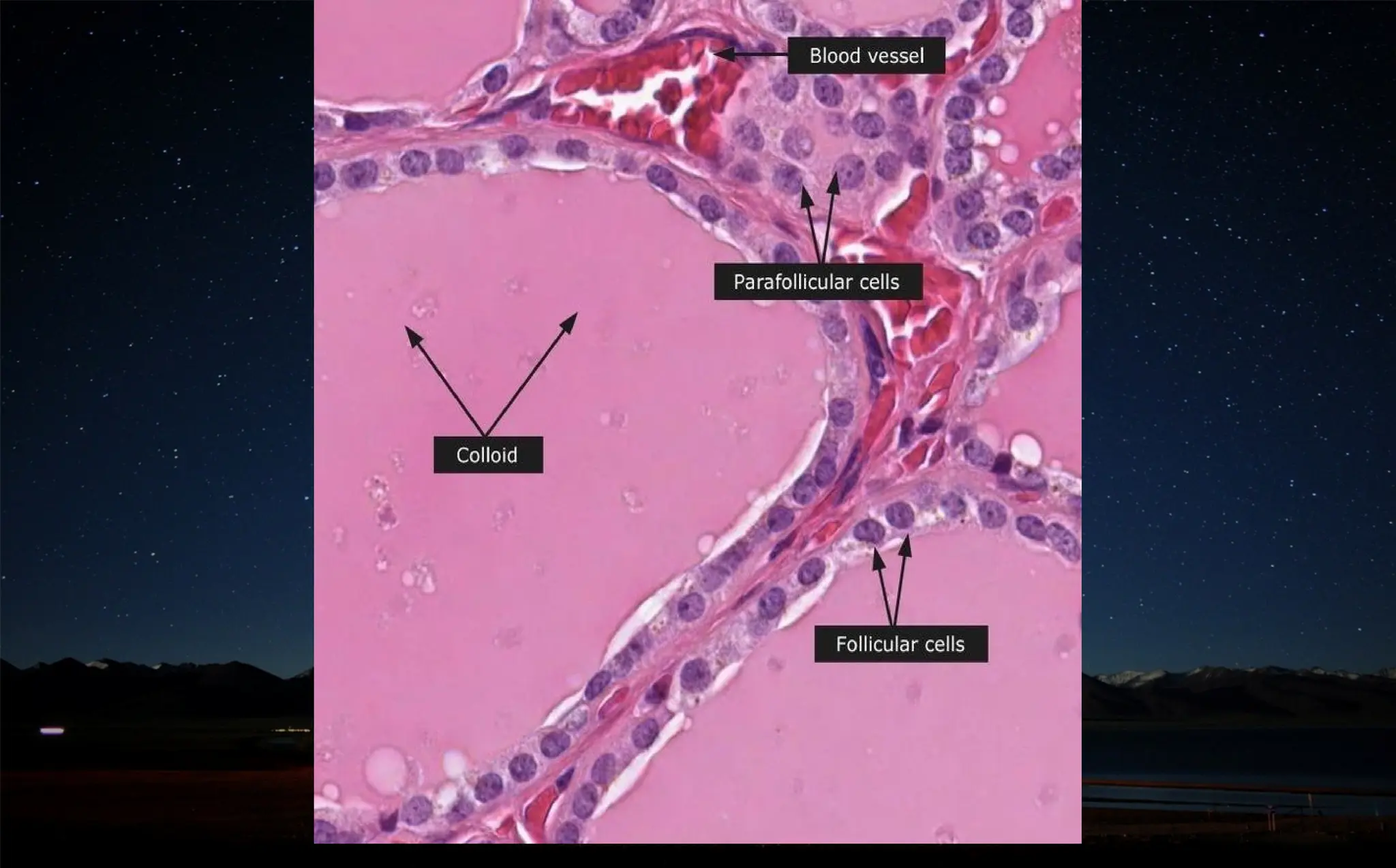 Share Thyroid gland ppt-1-2.pptx anatomy | PPTX