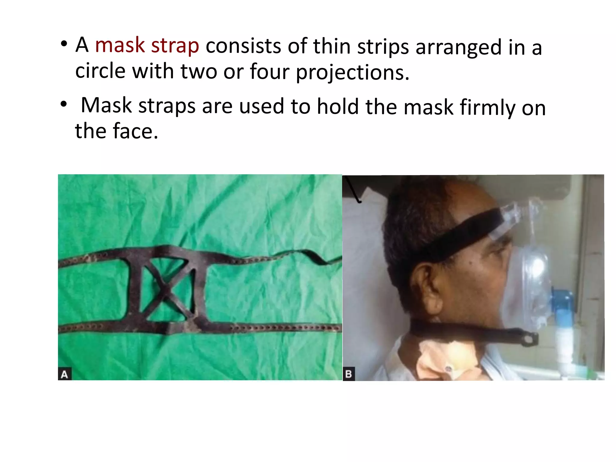 Techniques of mask ventilation | PPTX