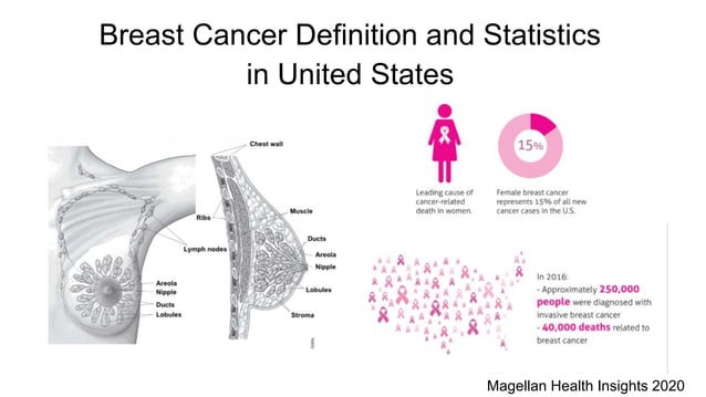 When Cells Go Rogue and Become Breast Cancer | PPT