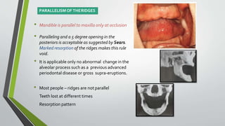 vertical jaw relation | PPTX