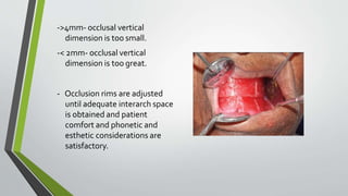 vertical jaw relation | PPTX