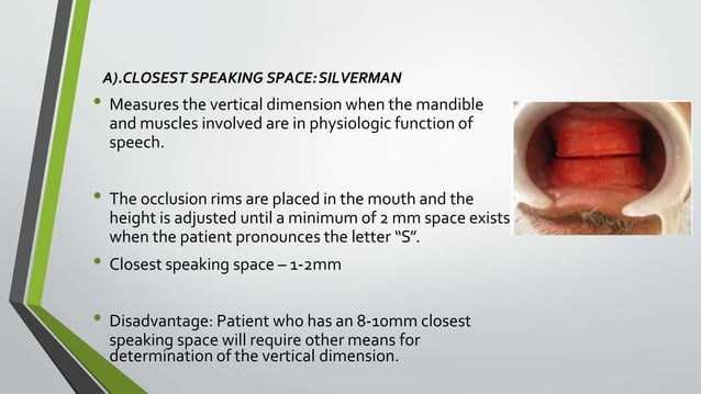 vertical jaw relation | PPTX | Dental Health | Diseases and Conditions