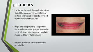 vertical jaw relation | PPTX