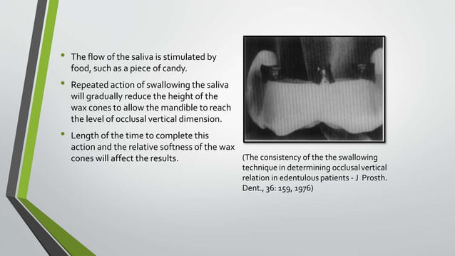 vertical jaw relation | PPTX | Dental Health | Diseases and Conditions