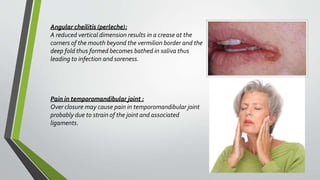 vertical jaw relation | PPTX