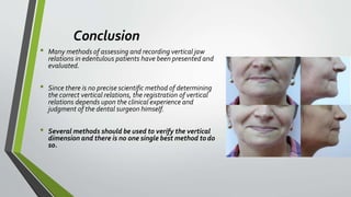 vertical jaw relation | PPTX