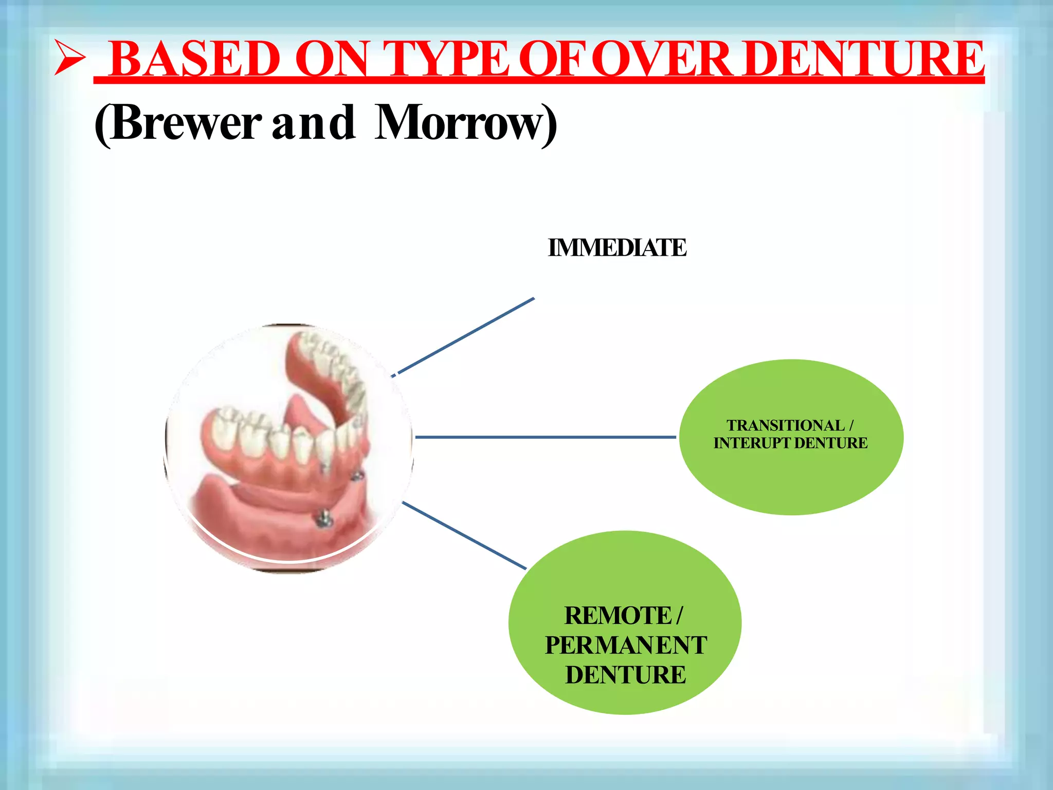 TOOTH SUPPORTED OVERDENTURE | PPTX