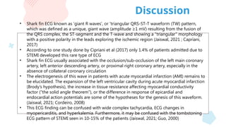ecg sign ppt shark fin123456789101112141516 | PPT