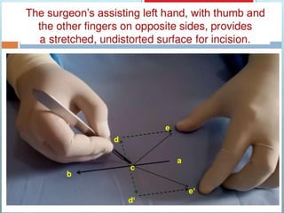 Sharp instruments (blade, bp handle, scissor needle, suture material) | PDF
