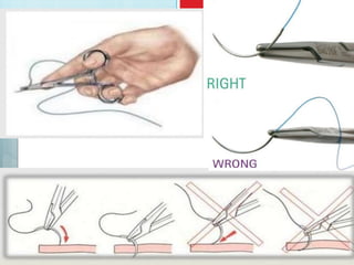Sharp instruments (blade, bp handle, scissor needle, suture material) | PDF