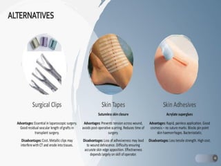 Sharp instruments (blade, bp handle, scissor needle, suture material) | PDF