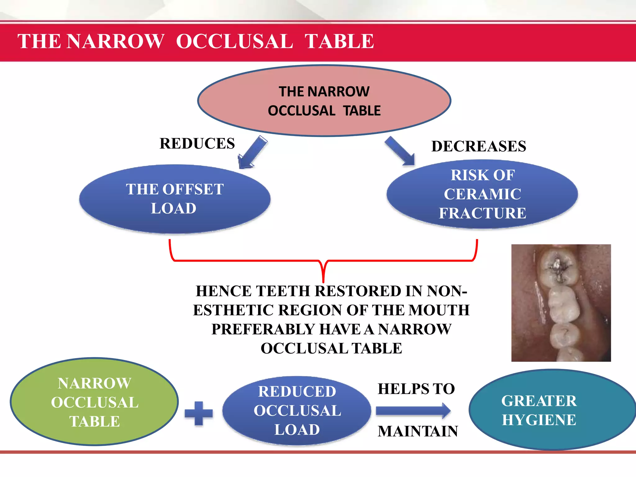 IMPLANT OCCLUSION | PPTX