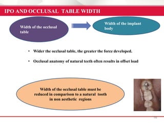 IMPLANT OCCLUSION | PPTX