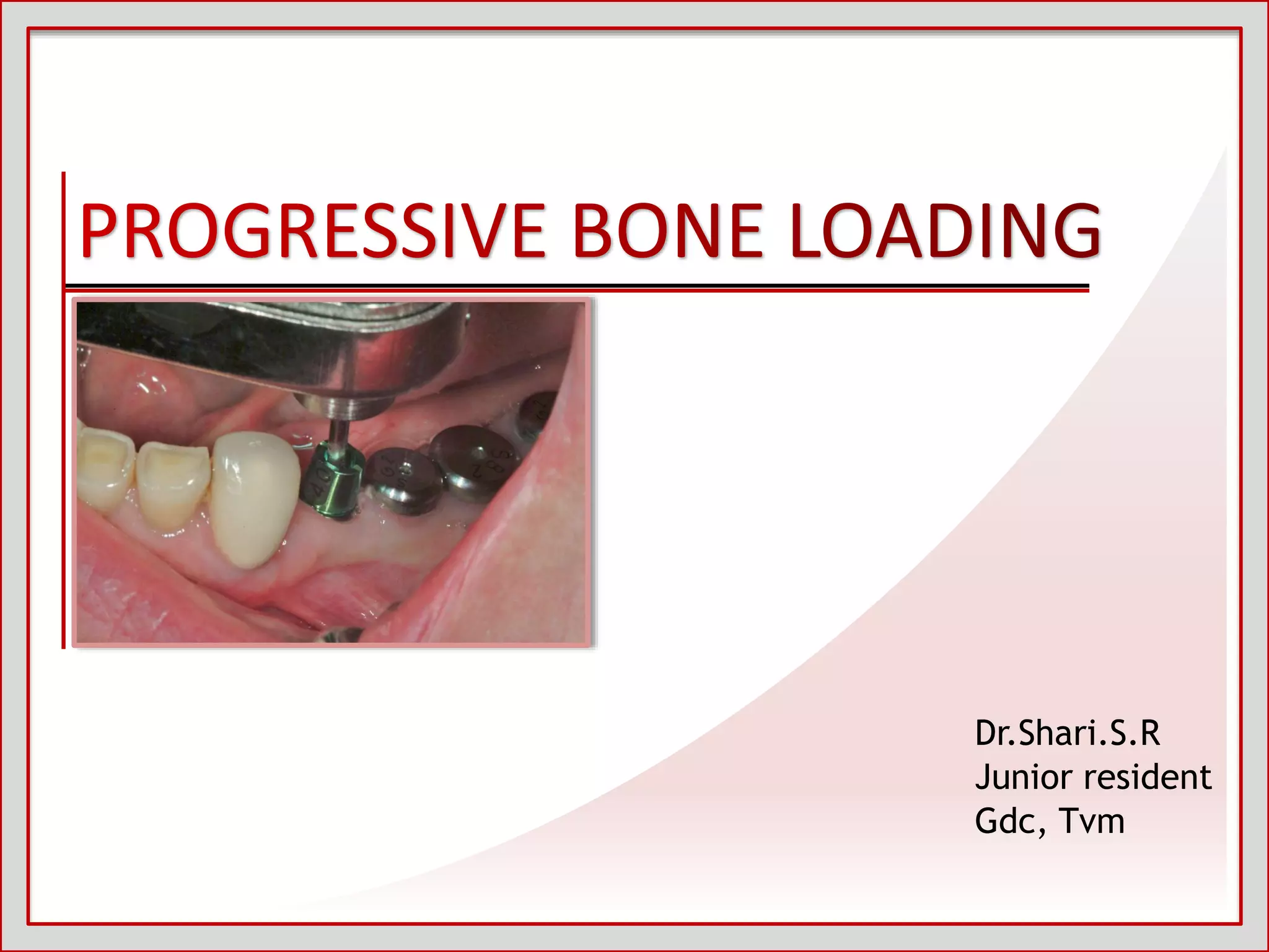 PROGRESSIVE LOADING IN IMPLANTS | PPTX