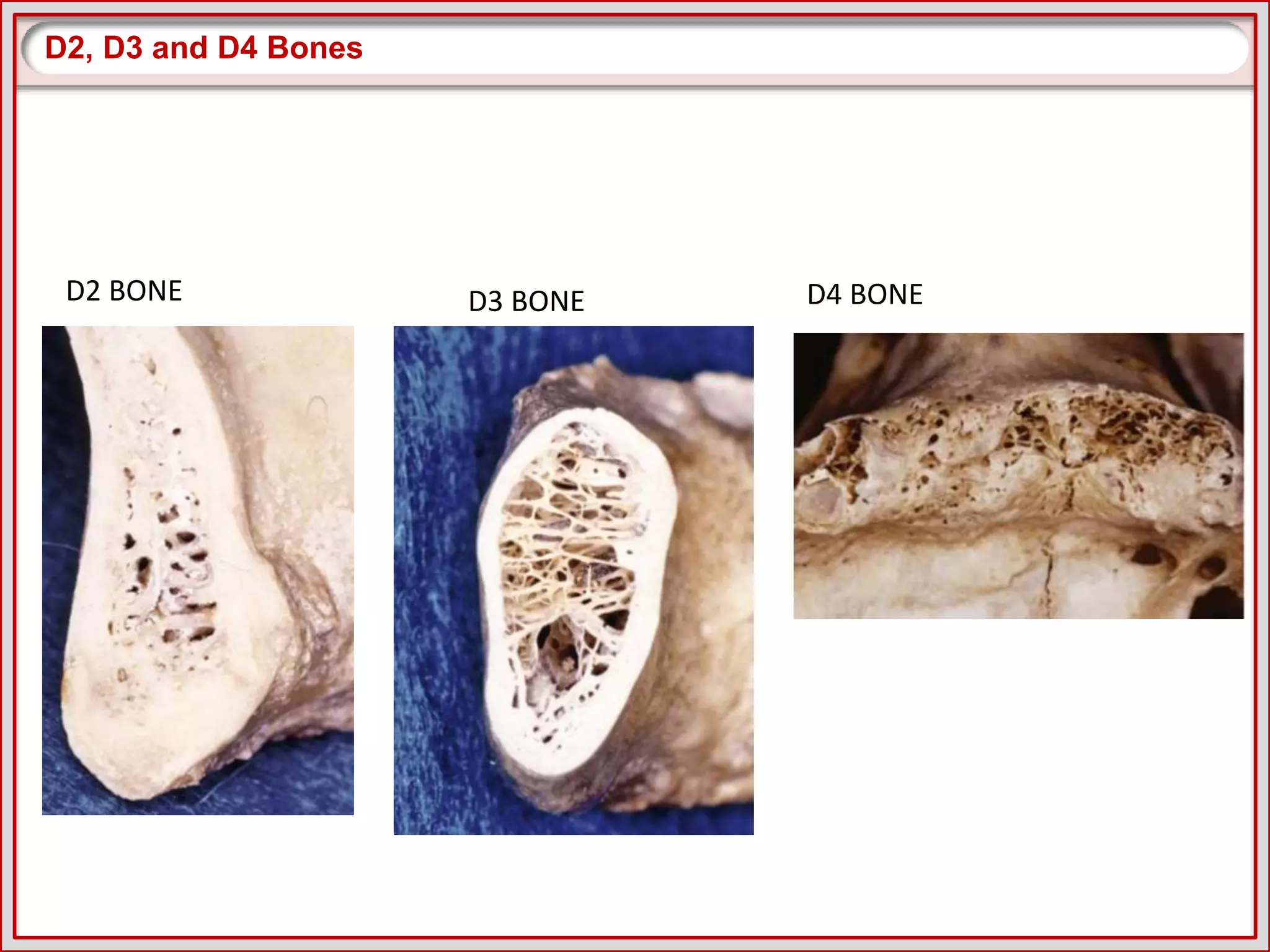 PROGRESSIVE LOADING IN IMPLANTS | PPTX