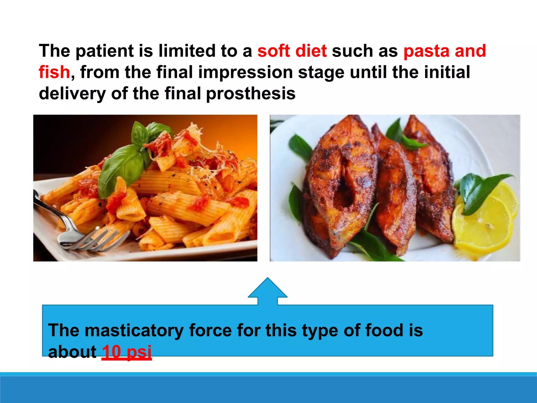 PROGRESSIVE LOADING IN IMPLANTS | PPTX