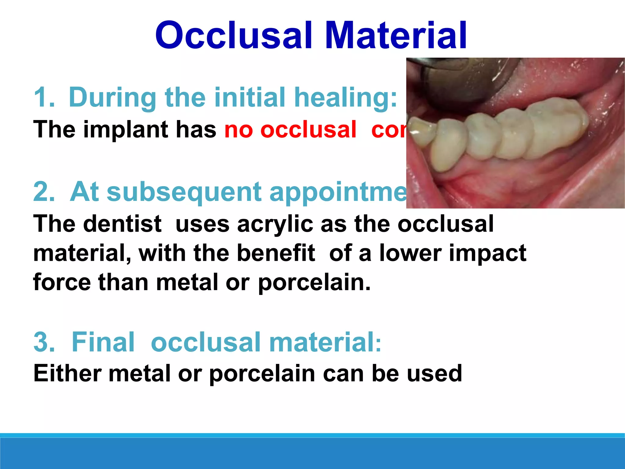 PROGRESSIVE LOADING IN IMPLANTS | PPTX
