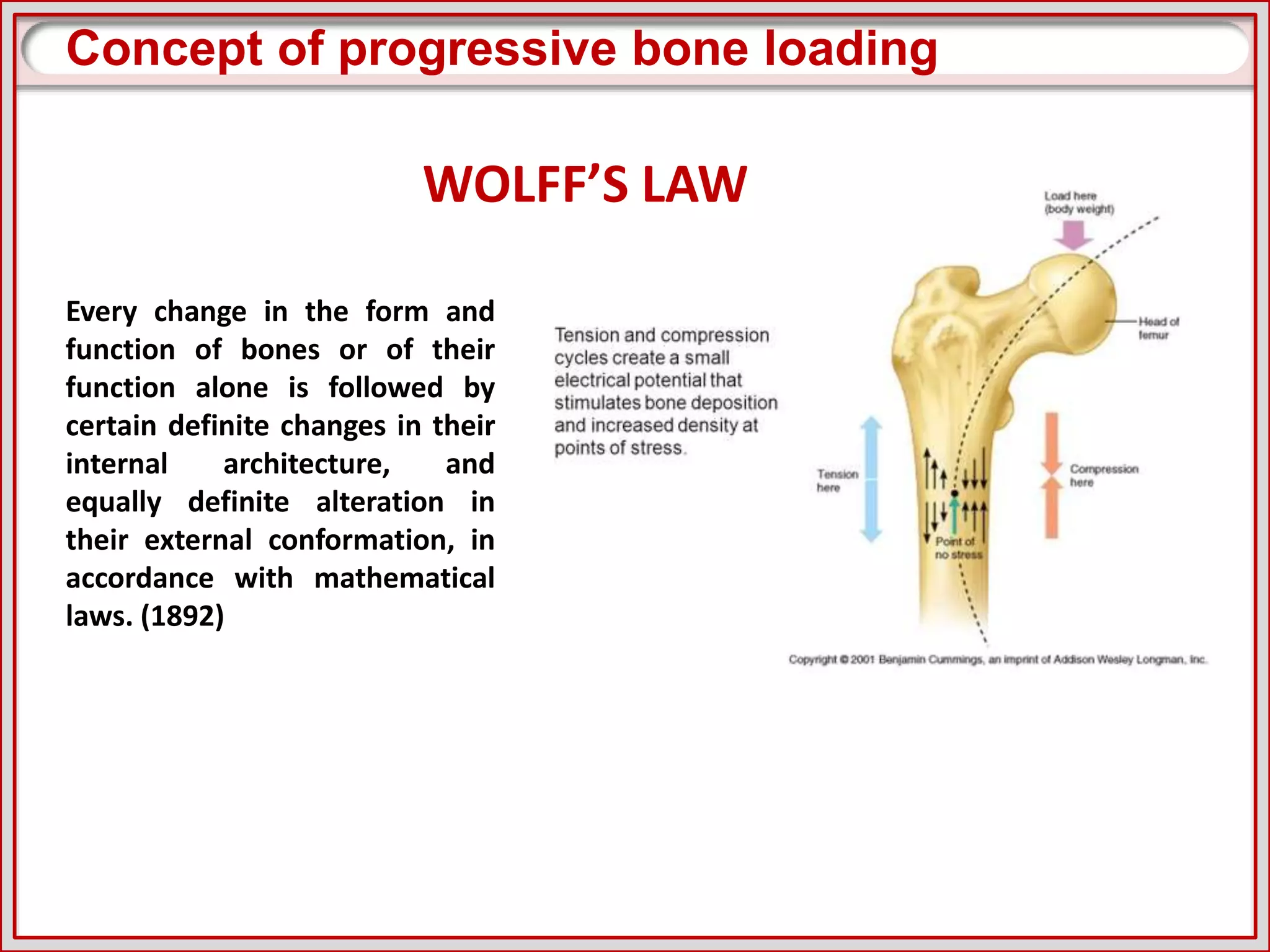 PROGRESSIVE LOADING IN IMPLANTS | PPTX