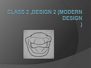 Modifications of Class 2 Cavity preparations | PPTX