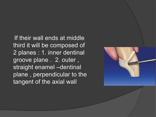 Modifications of Class 2 Cavity preparations | PPTX | Oral care ...